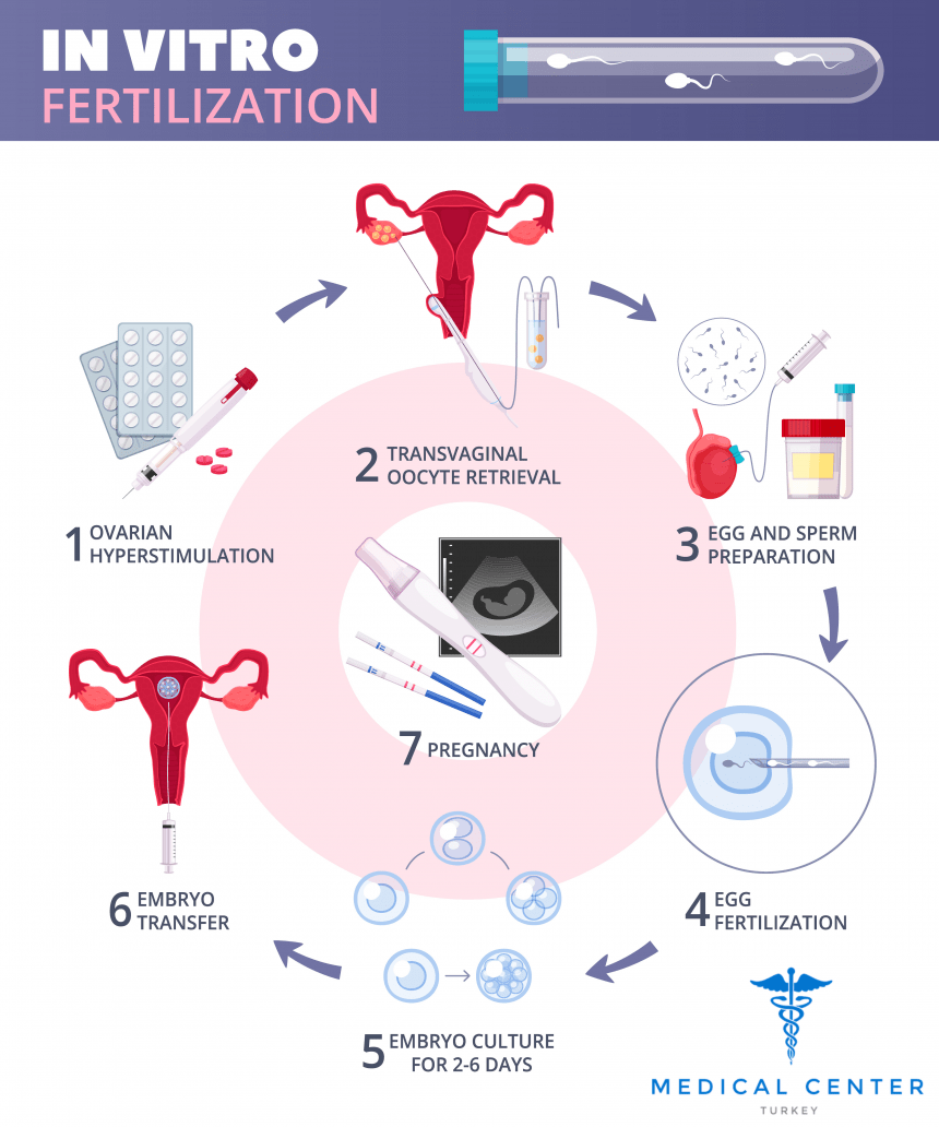 IVF in Turkey In-Vitro Fertilisation IVF - Aesthetic Travel